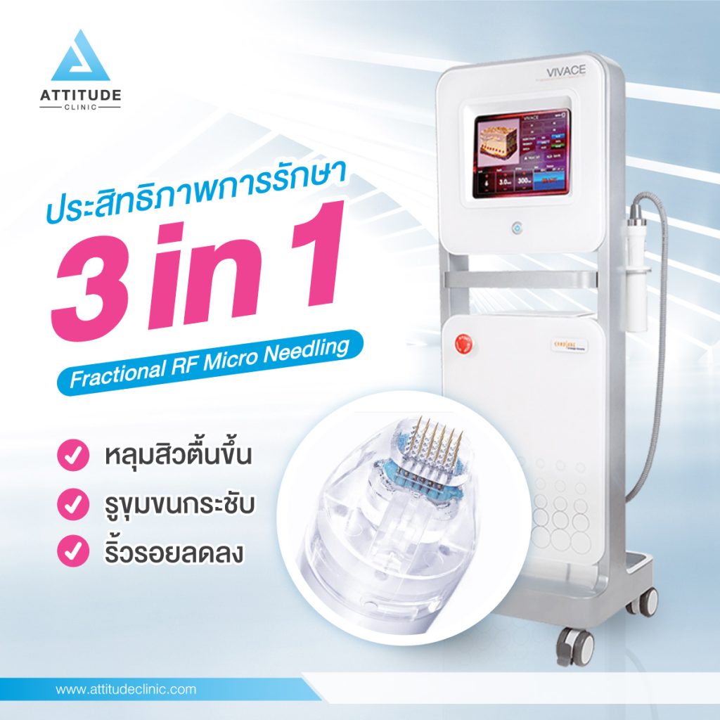 Fractional RF Micro Needling ประสิทธิภาพการรักษา 3 in 1 - ATTITUDE ...