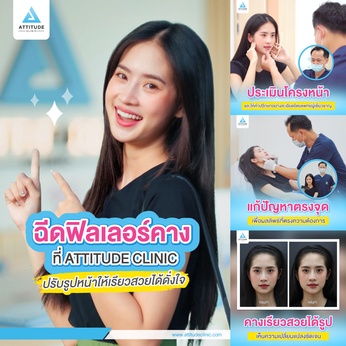 ฉีดฟิลเลอร์คางที่ Attitude Clinic ปรับรูปหน้าให้เรียวสวยได้ดั่งใจ - ATTITUDE CLINIC | คลินิกความ ...