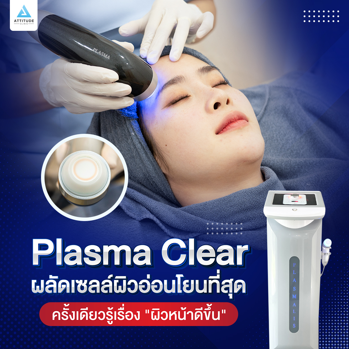 ครั้งเดียวรู้เรื่อง !! สิ่งสกปรกหลุดออกหมด หน้าใสขึ้น สิวผดหายไปเลย ด้วย Plasma Clear - ATTITUDE ...