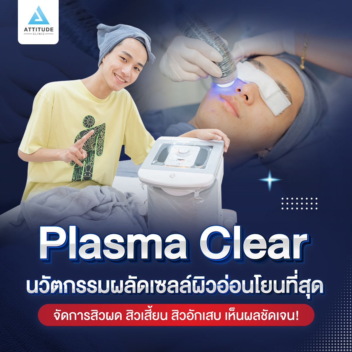 รักษาสิวผด สิวอุดตัน สิวเซ็บเดิร์มได้ง่ายๆ ด้วย Plasma Clear - ATTITUDE CLINIC | คลินิกความงาม ...
