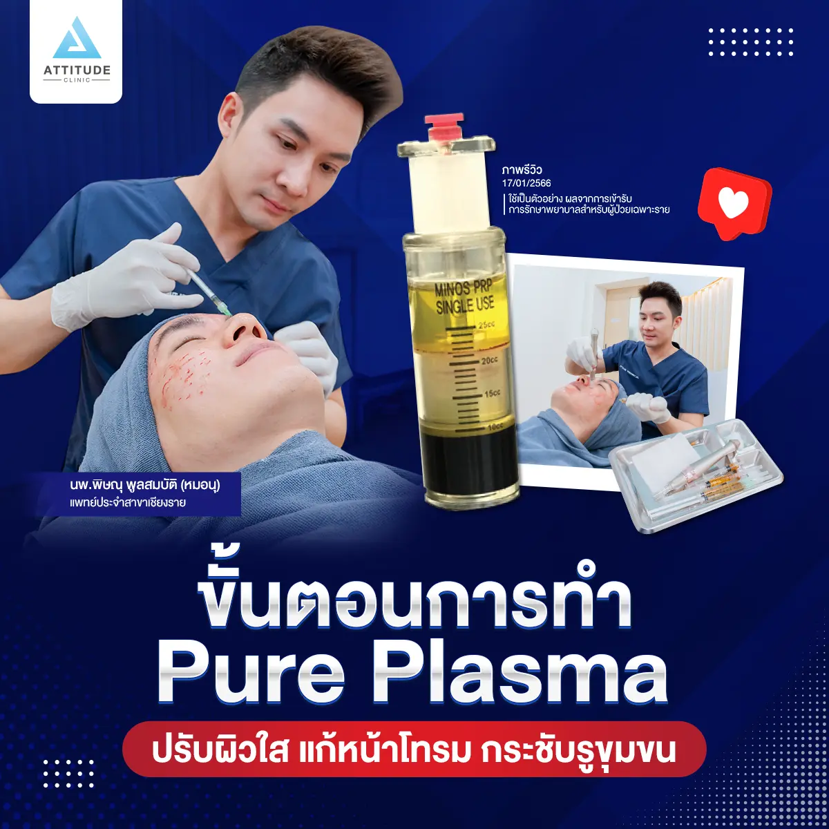 ขั้นตอนการทำ Pure Plasma ปรับผิวใส แก้หน้าโทรม กระชับรูขมขน ที่ ...