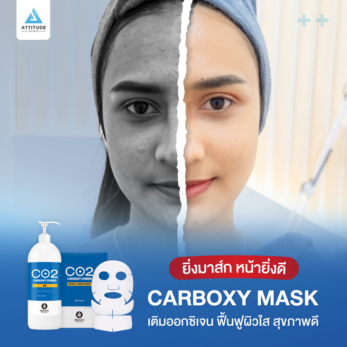 พาดูขั้นตอนการทำ Carboxy Mask มาสก์นวัตกรรมใหม่! เติมออกซิเจนได้อย่างไร ...