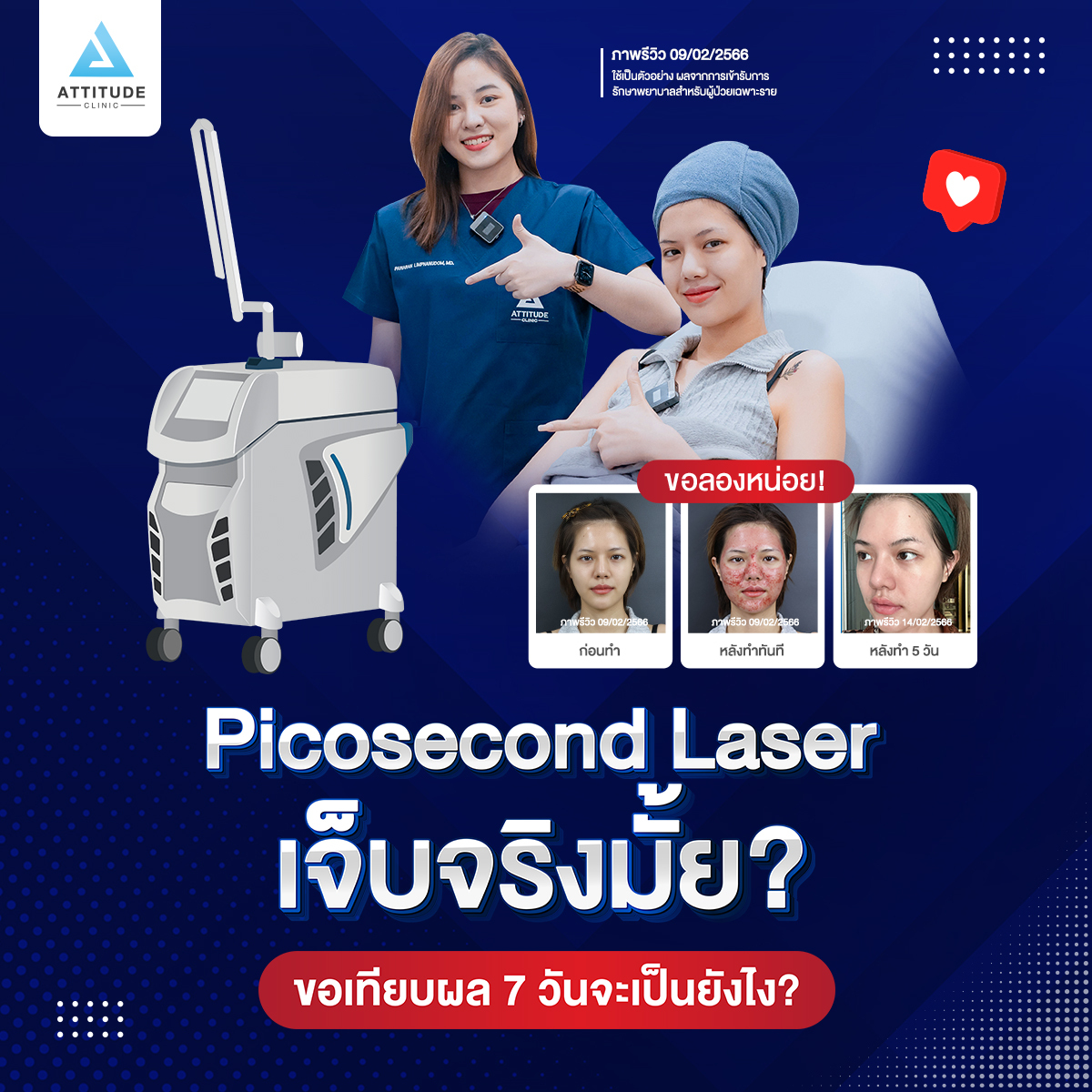 น้องแบมรีวิว Picosecond Laser ขอลองหน่อย เจ็บจริงมั้ย? - ATTITUDE ...