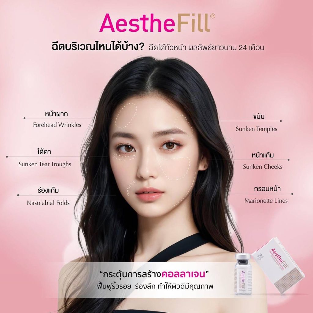 ข้อมูลครบ! ทำความรู้จัก AestheFill กระตุ้นคอลลาเจนด้วย PDLLA ตัวดังจากเกาหลี ช่วยให้ผิวกระชับ ...