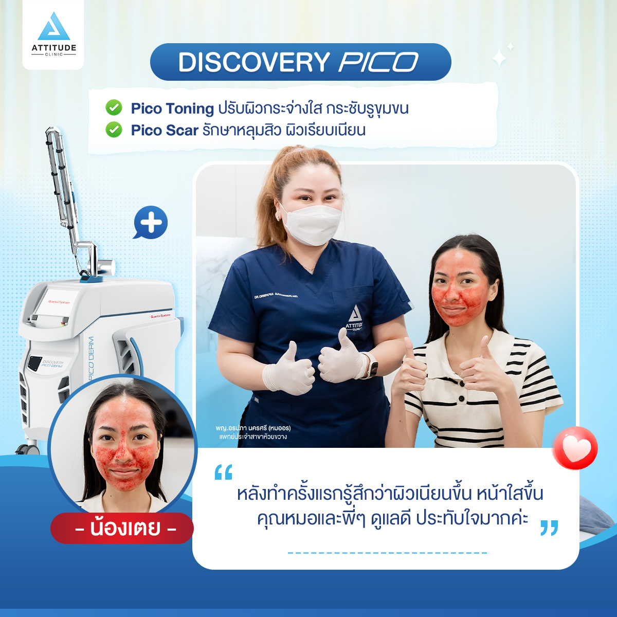 รีวิวทำ Discovery Pico จากลูกค้า เลเซอร์เลือดสาดตัวดังจากอิตาลี รักษา ...