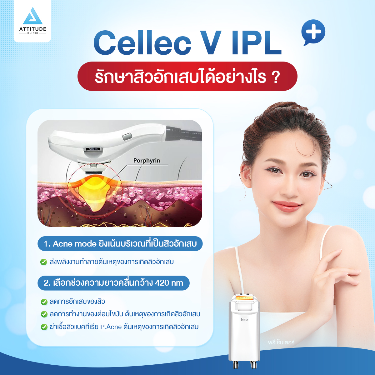 รักษาสิวอักเสบ ด้วยเลเซอร์หน้าใส Cellec V IPL