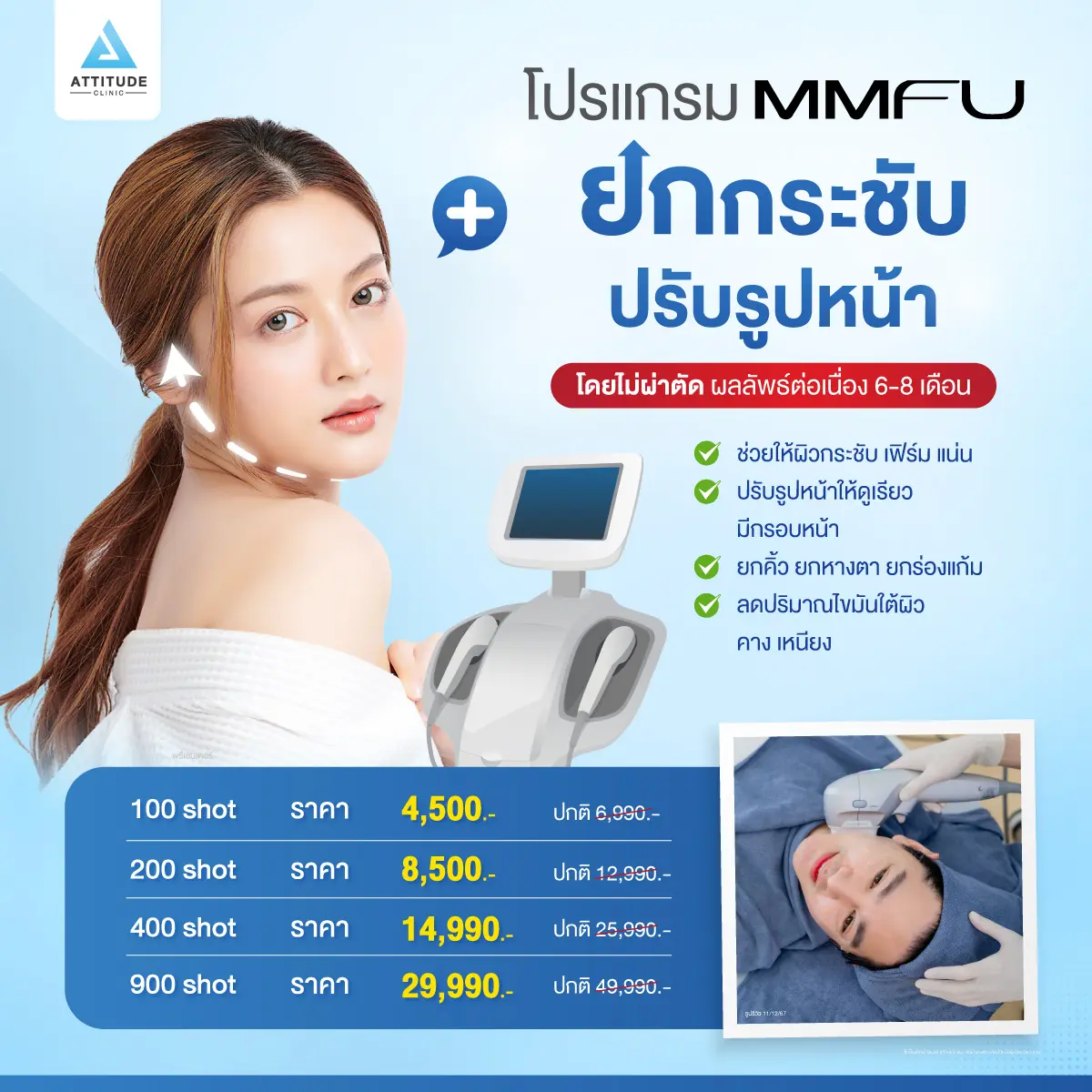 เสิร์ฟโปรแกรมยกหน้าแบบไม่ต้องใช้เข็ม [โปรโมชั่น] โปรแกรม MMFU ยกกระชับใบหน้า ยกพยุงผิวปรับรูป ...